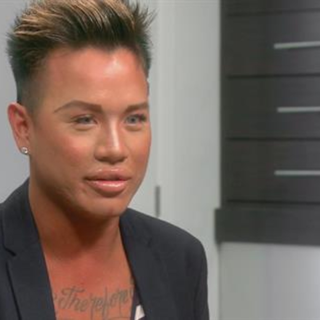 Botched Patient Is Obsessed With Big Doll Like Lips E Online